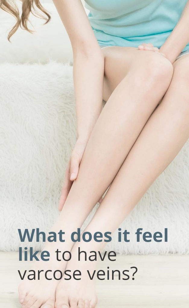 What Does It Feel Like To Have Varicose Veins Vein Health